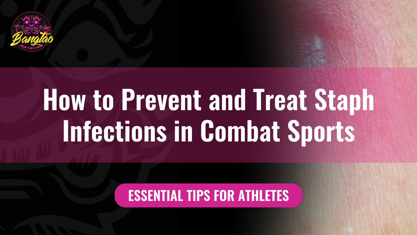 How to Prevent and Treat Staph Infections in Combat Sports