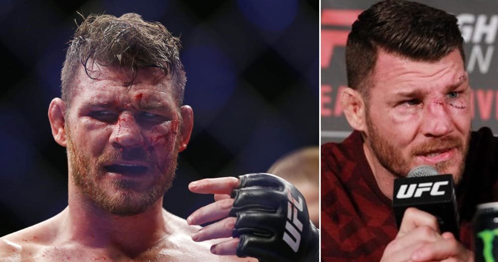 Bisping’s Secret: Fighting Blind in the UFC